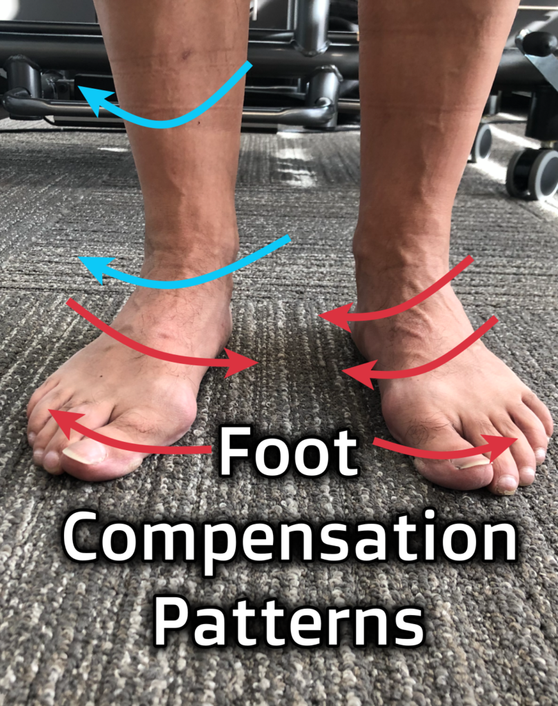 Foot Compensation Patterns – ZacCupples.com