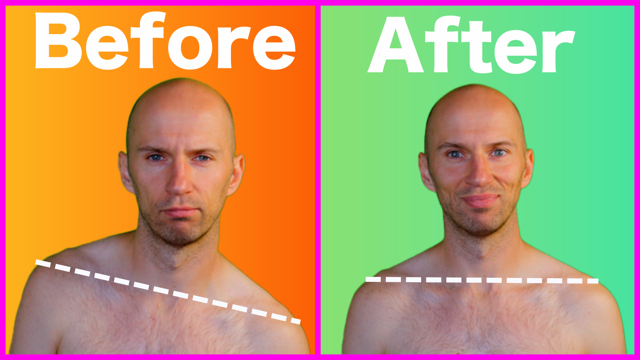 Why is My Left Shoulder Lower Than My Right? – Biomechanics and ...