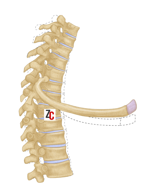 Uneven Rib Flare – Fix it For Good – ZacCupples.com