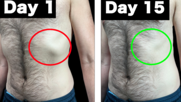 The BEST Rib Flare Fixing Exercise – ZacCupples.com