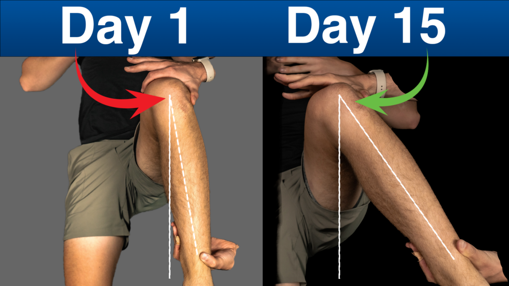 Upgrade Your Hip Mobility (FAST) – ZacCupples.com