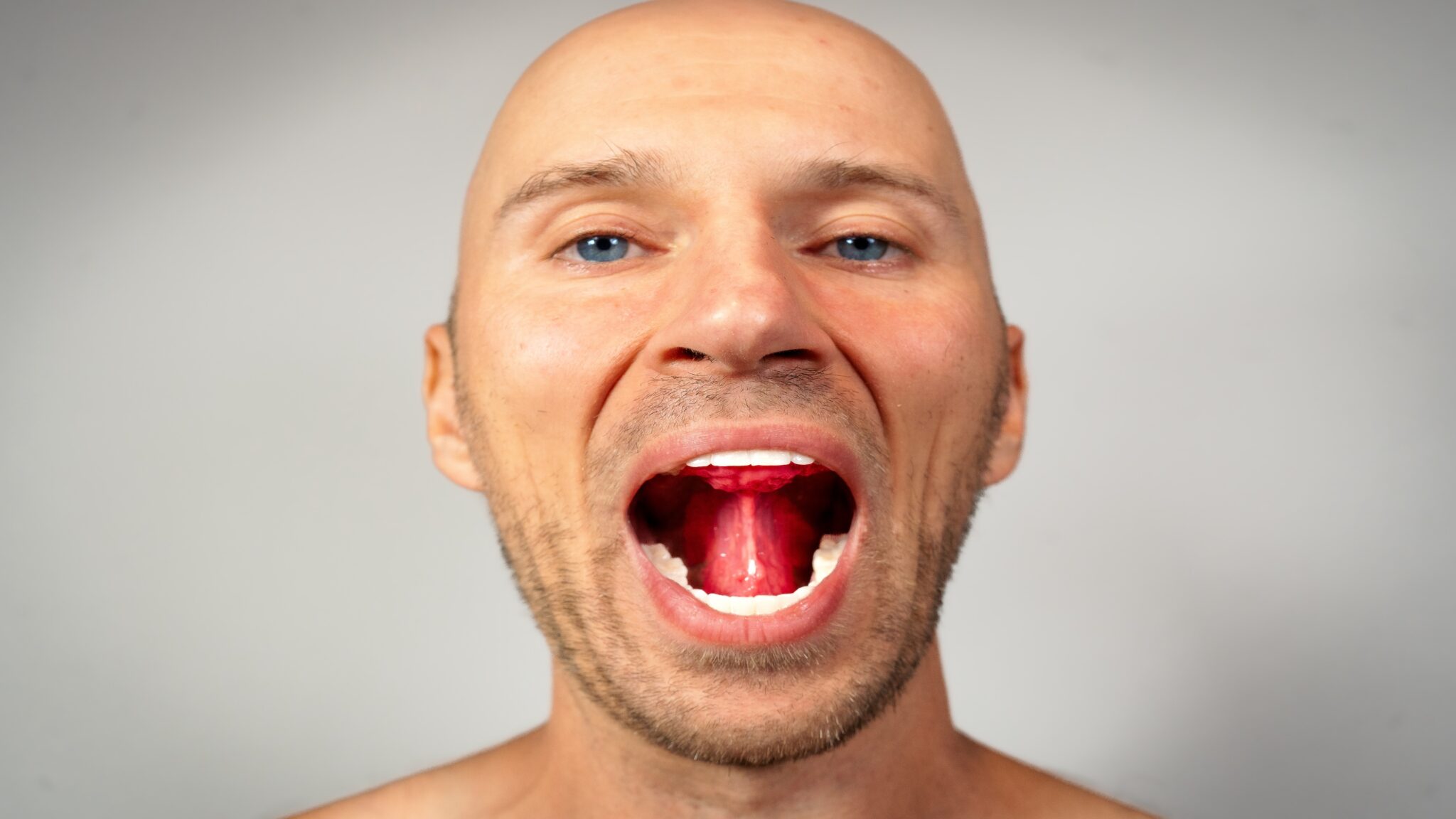 Improving Tongue Posture: The Overlooked Key to Better Health ...