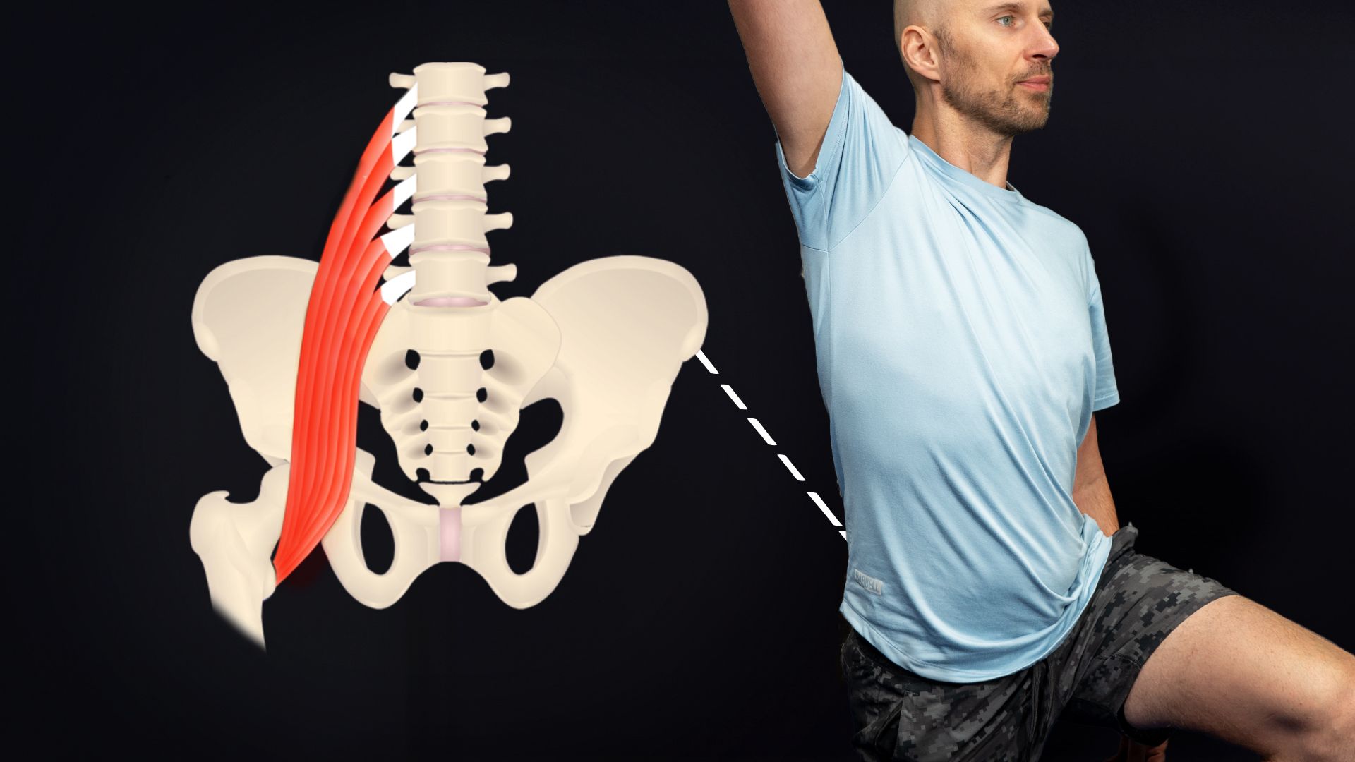 20 Second Tight Psoas Release (& Fix Long-Term) – ZacCupples.com