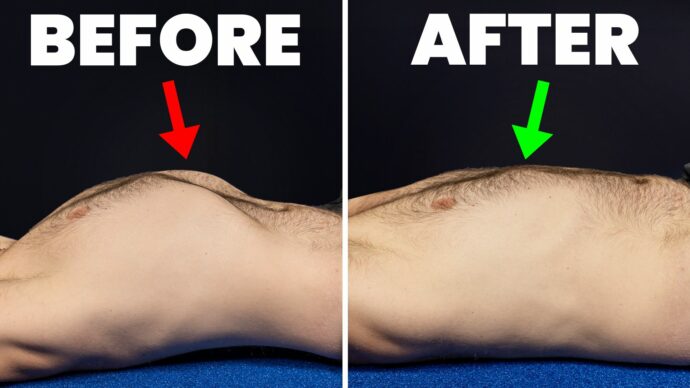Fix Rib Flare FAST (In Less Than 5 Minutes a Day) – ZacCupples.com