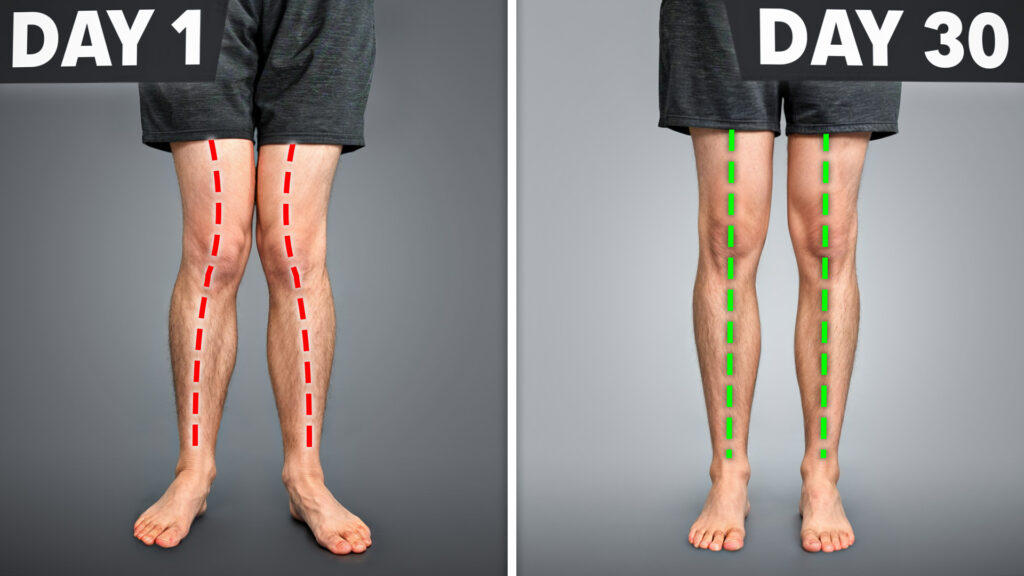 Fix 90% of Knee Problems in 30 Days – ZacCupples.com