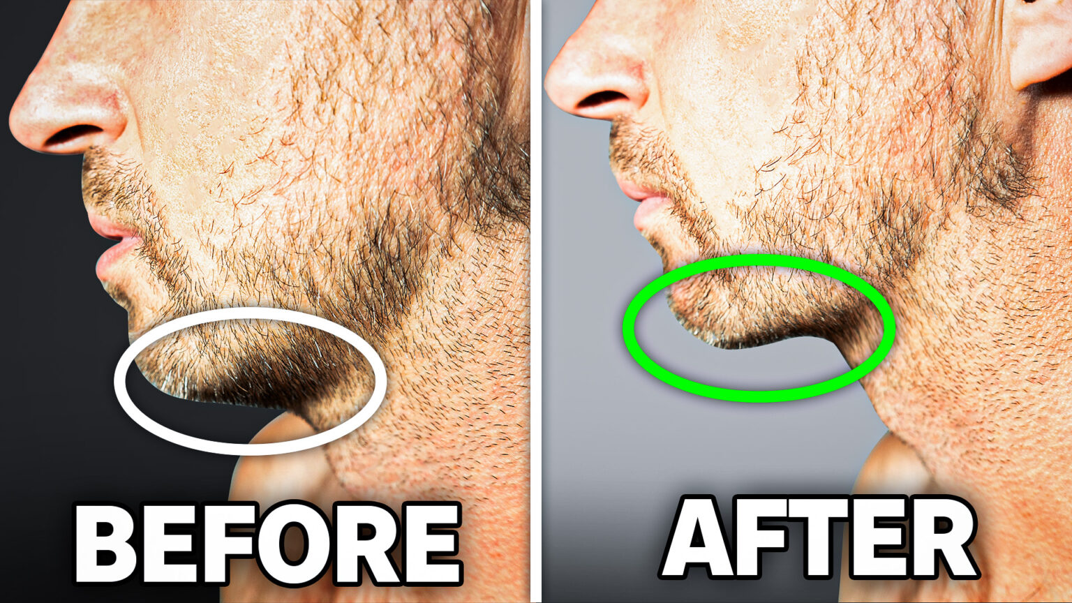 Fixing All Mewing MISTAKES (the complete guide) – ZacCupples.com